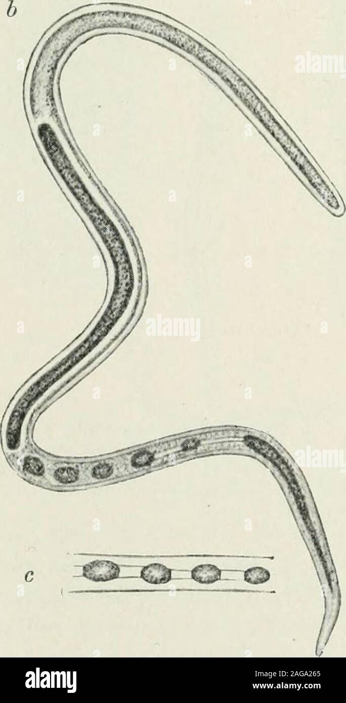 Muscle Parasite High Resolution Stock Photography and Images - Alamy