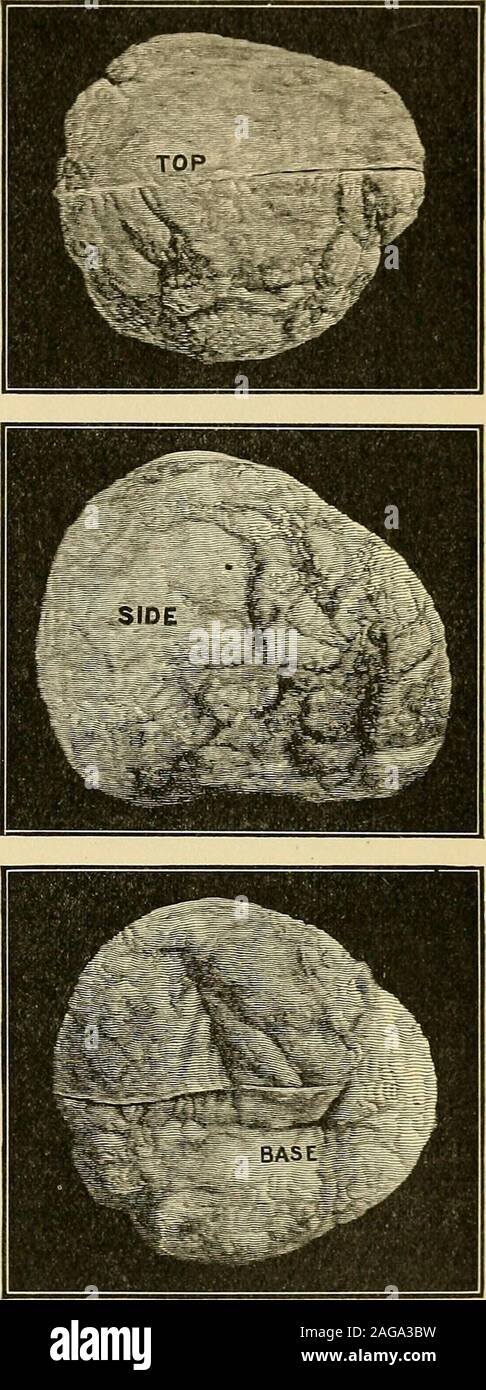 Enucleated hi-res stock photography and images - Alamy