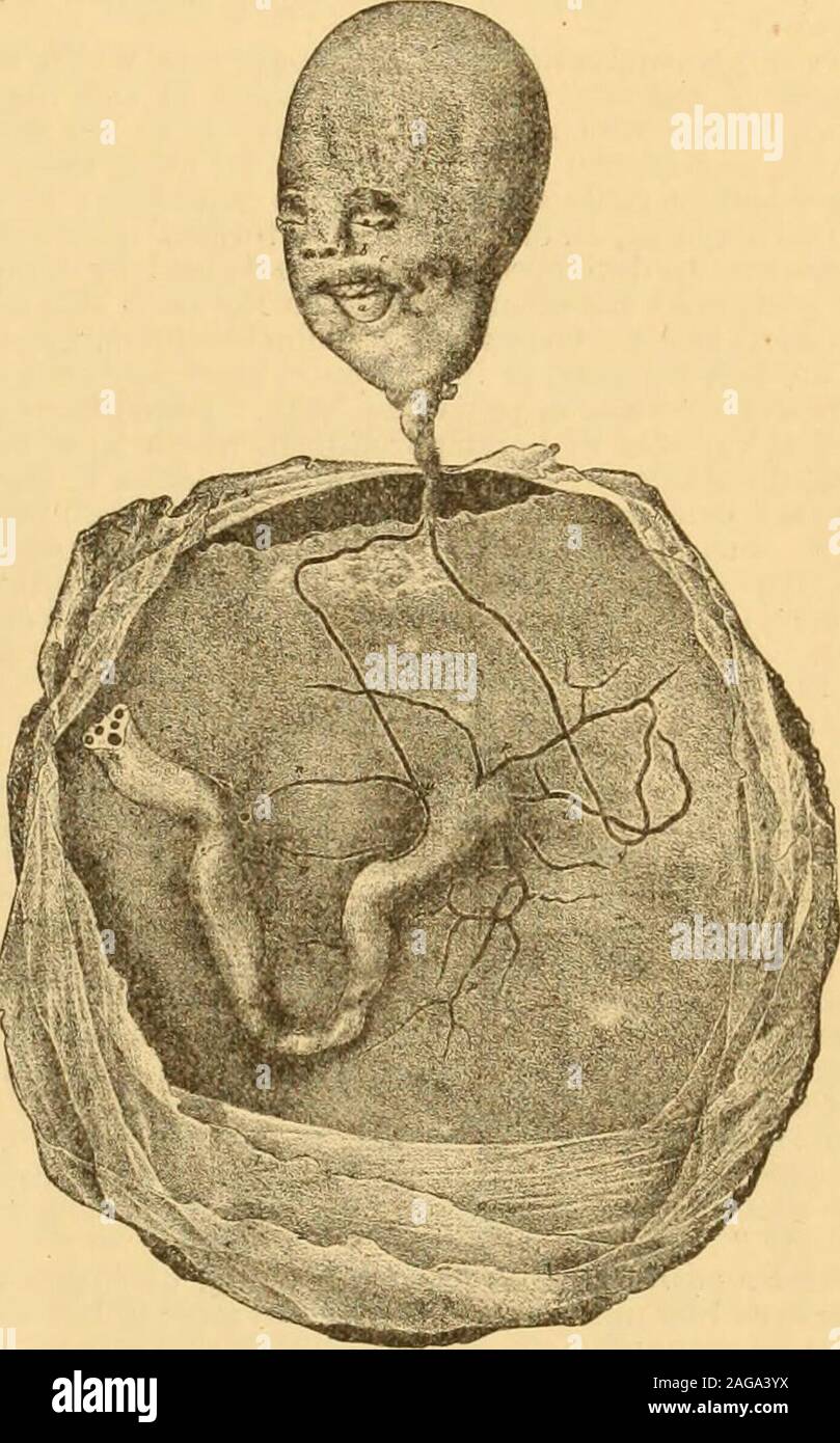 Tautology hi-res stock photography and images - Alamy