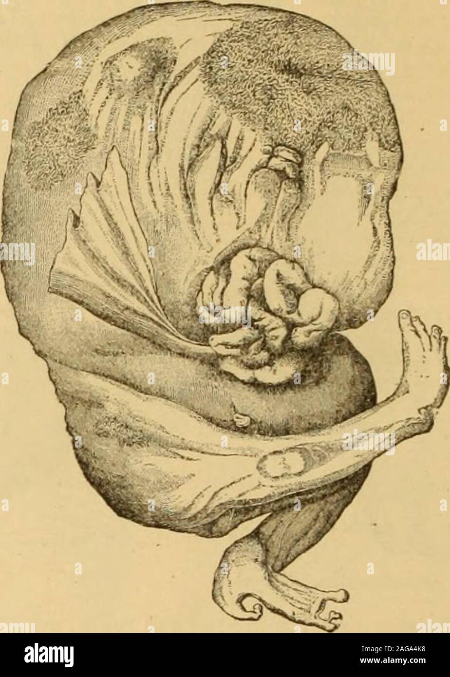 . A Reference handbook of the medical sciences : embracing the entire ...