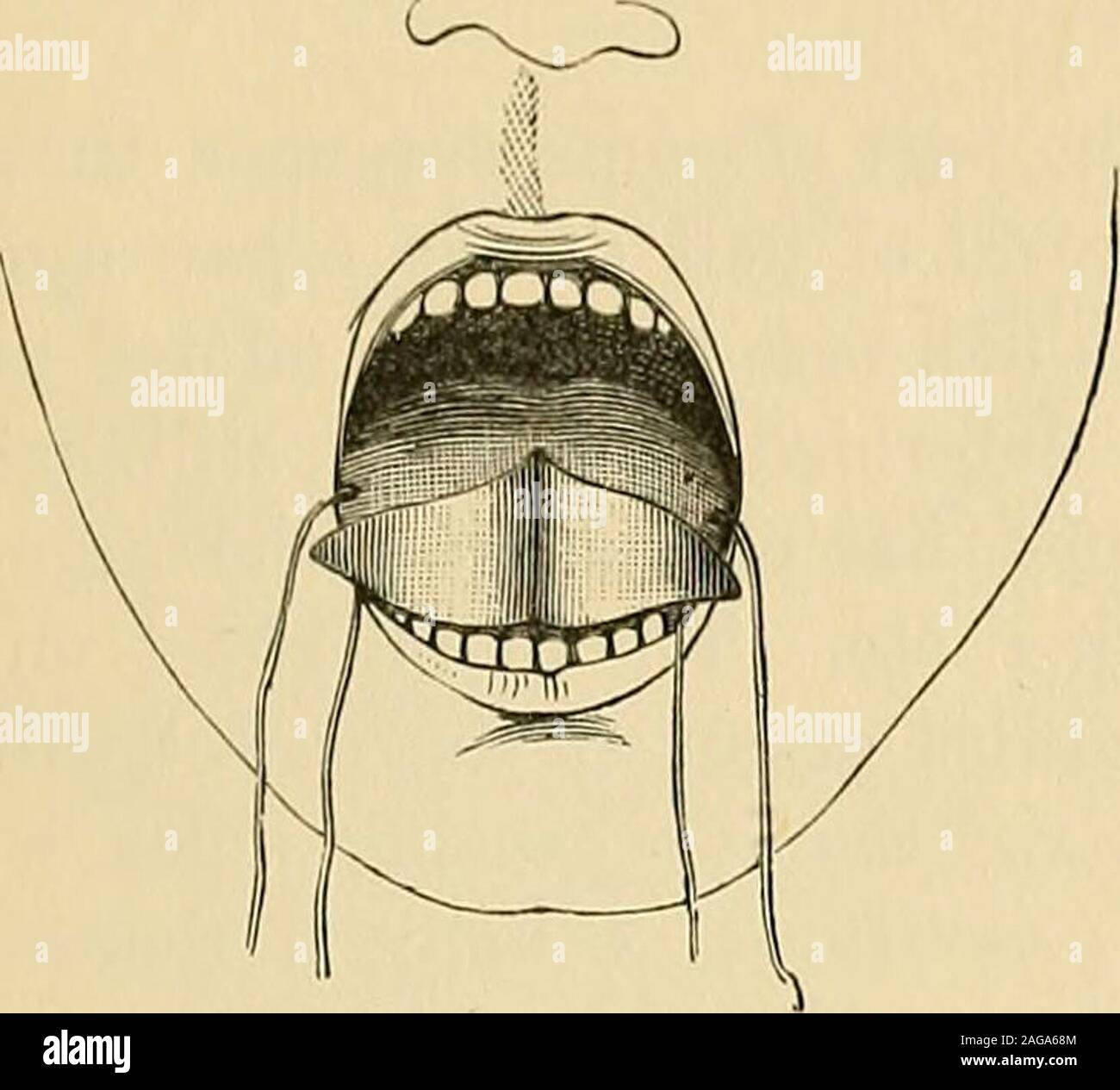 Bone cutting scissors hi-res stock photography and images - Alamy