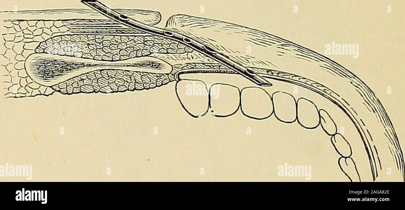 Bure loop hi-res stock photography and images - Alamy
