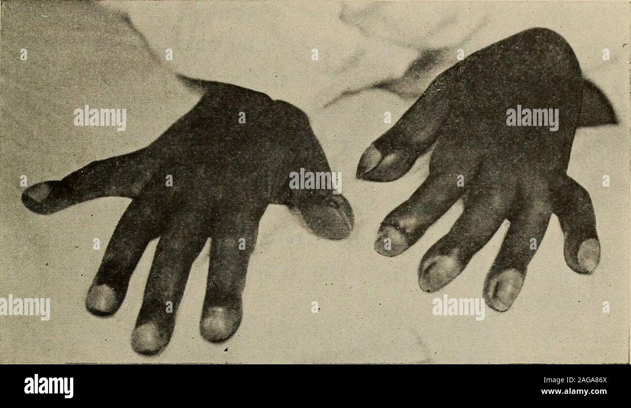 Water hammer pulse hi-res stock photography and images - Alamy