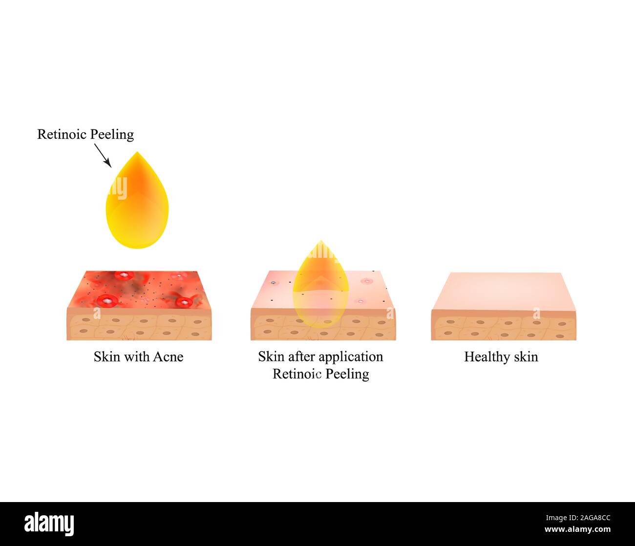 Structure peel Stock Vector Images - Alamy