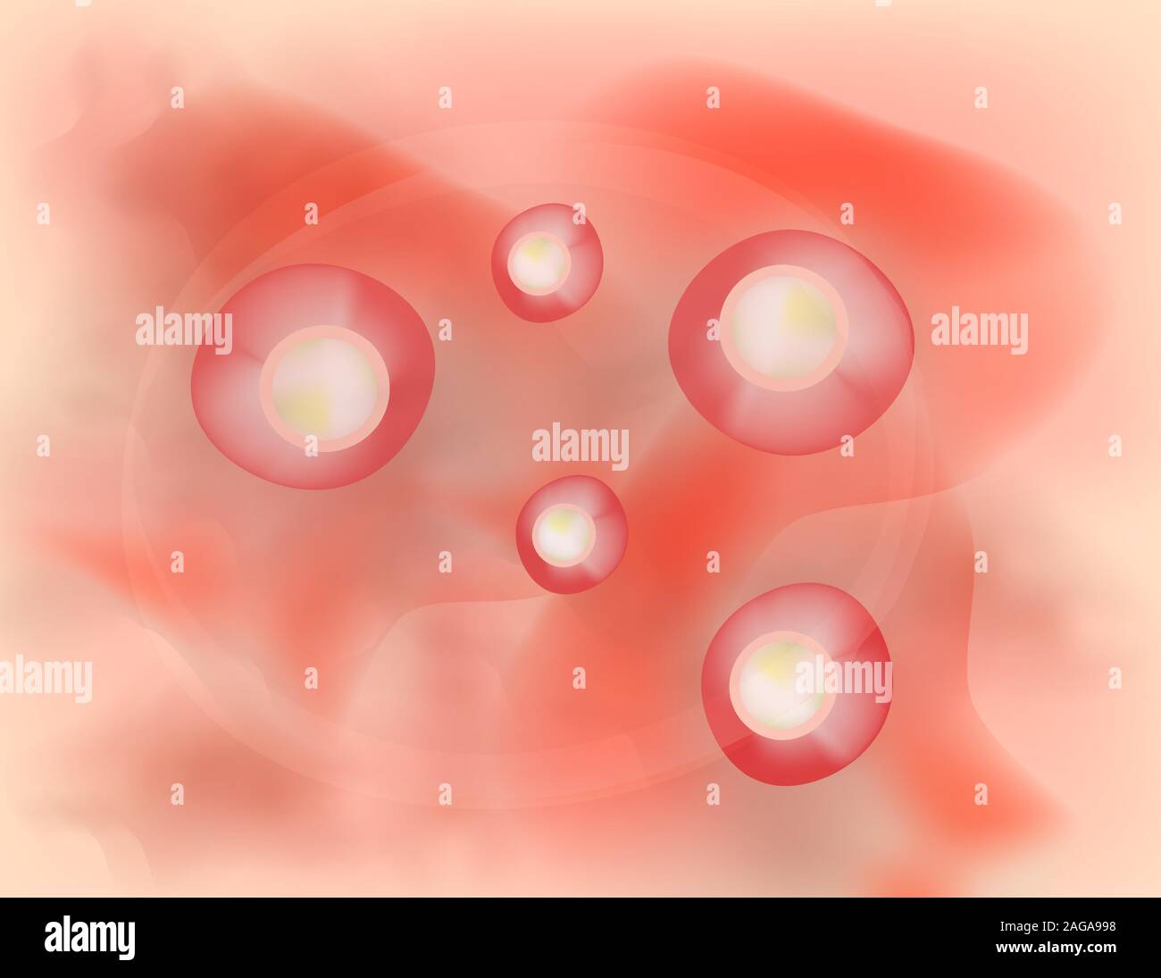 Skin illustration diagram disease cartoon hi-res stock photography and ...