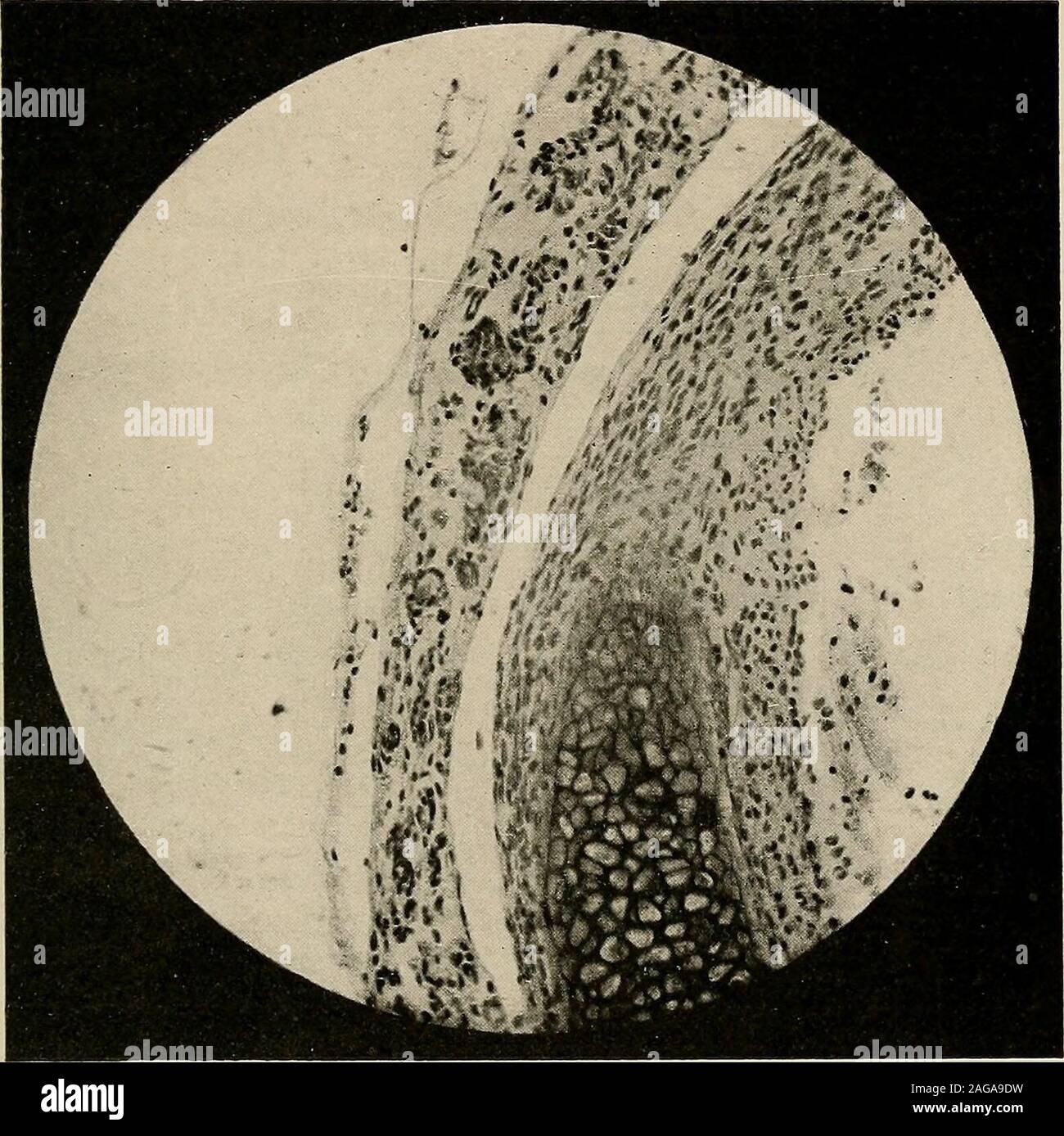 . The thyroid gland in health and disease. Fig. 49.—Section of normal ...