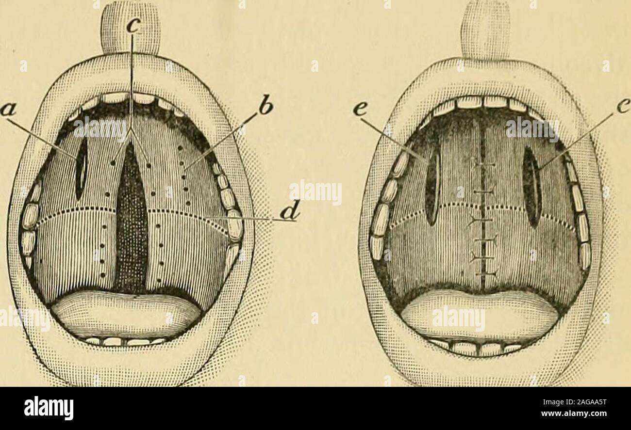 Silver palate hi-res stock photography and images - Alamy