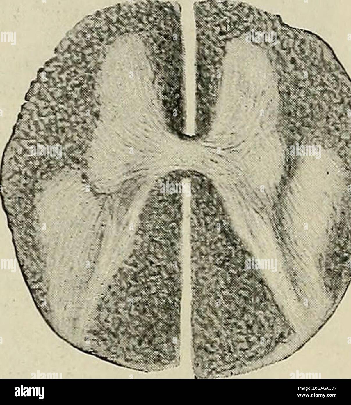 . A treatise on the nervous diseases of children : for physicians and ...