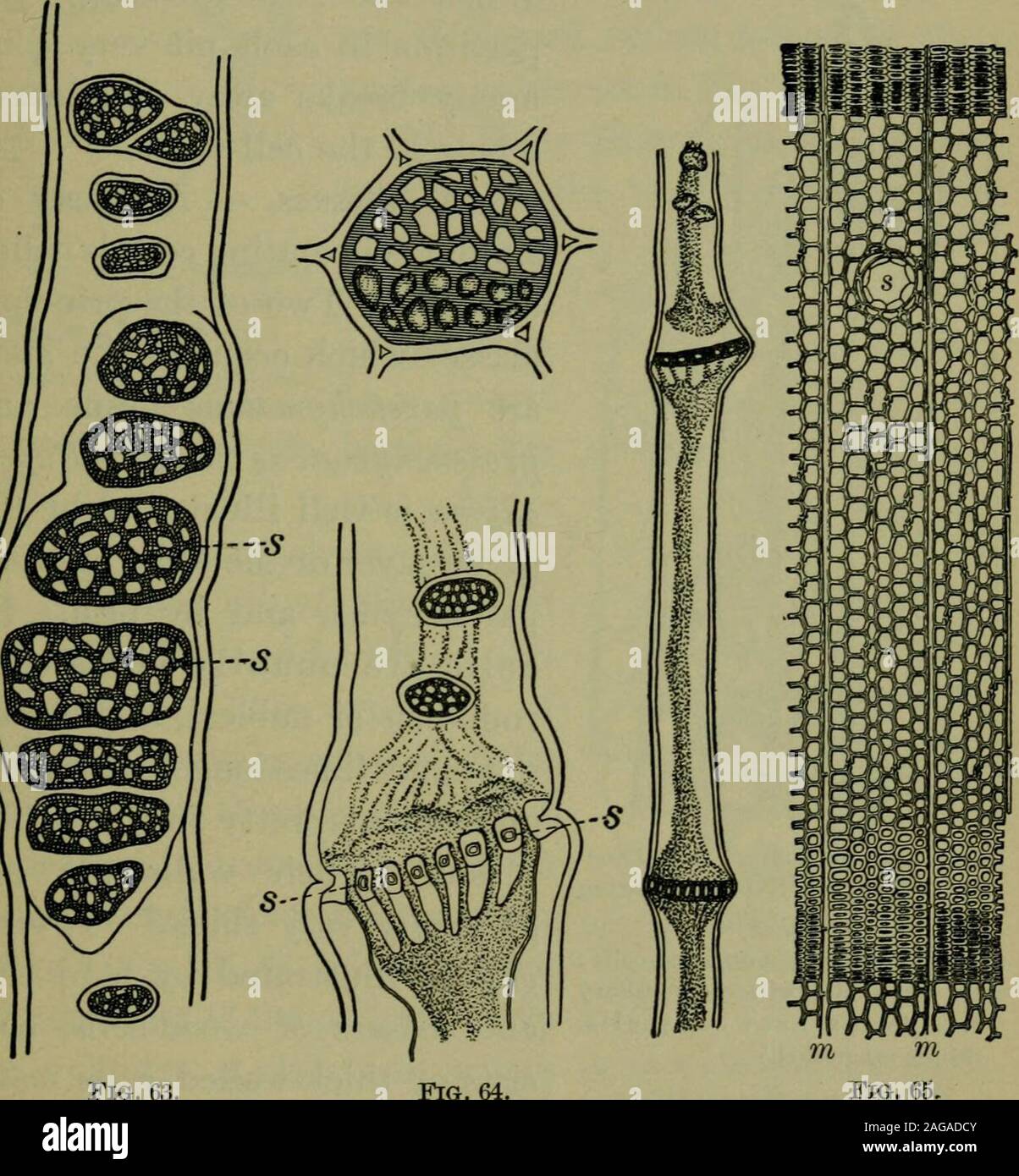 Stem Tracheids Fibers Vessels