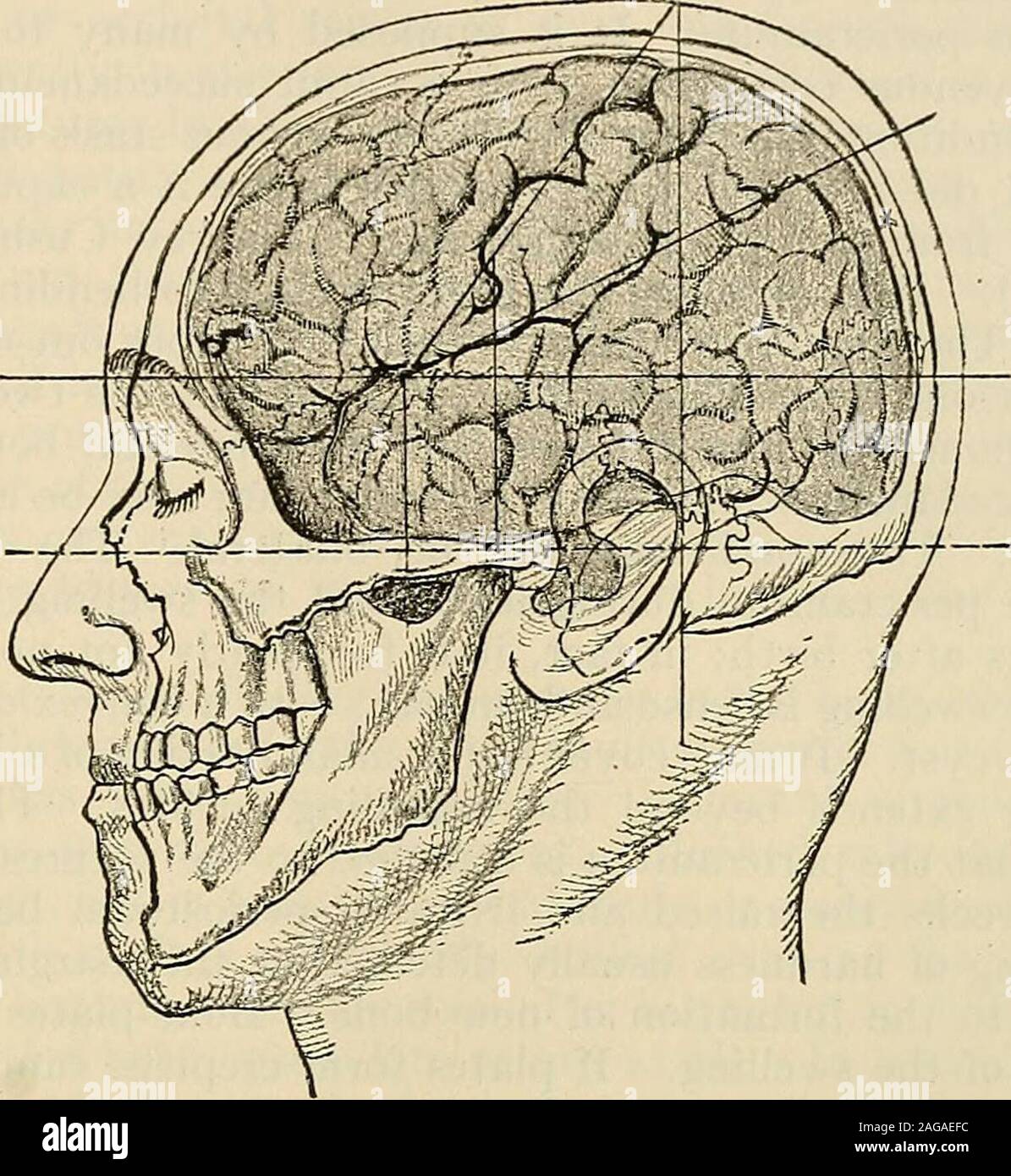 . Modern surgery, general and operative. the zygoma to the supra ...