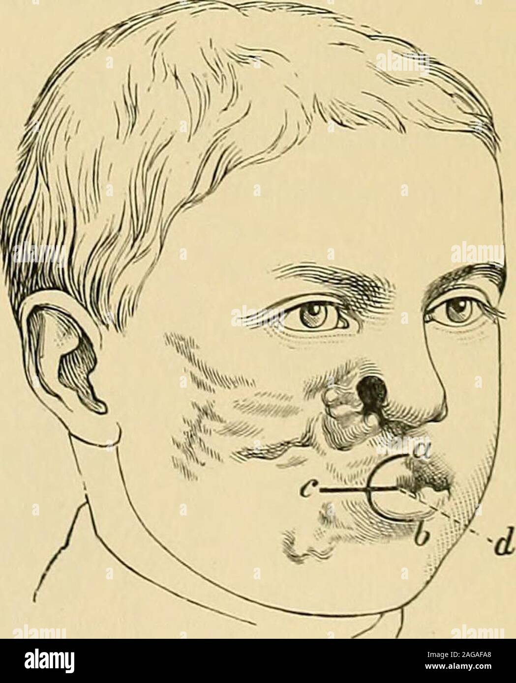 . Operative surgery. ans of transverse incisions made at theproper ...