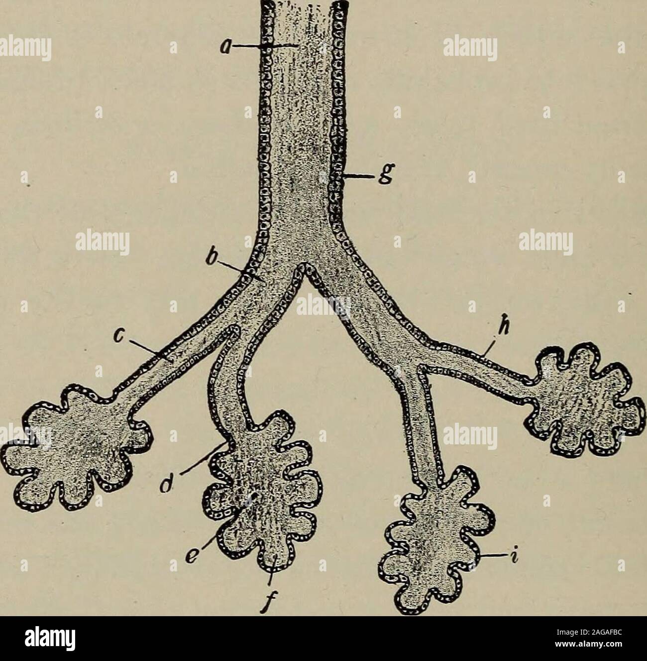 . Diseases of children. re is no expectoration. Children rarely expec ...