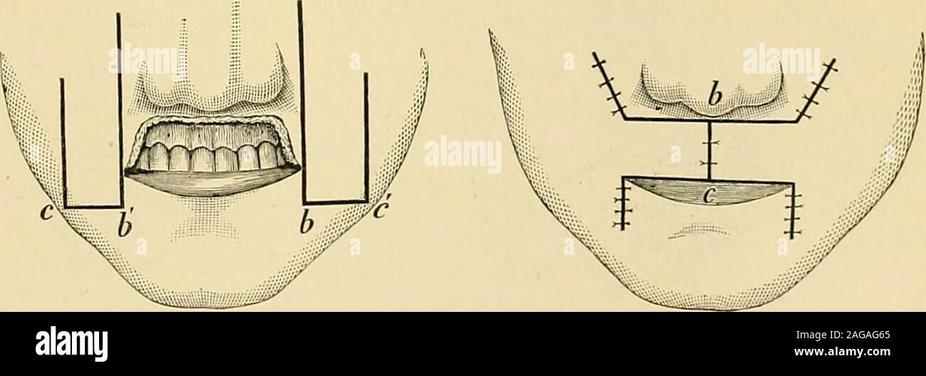 Entire cheek hi-res stock photography and images - Alamy