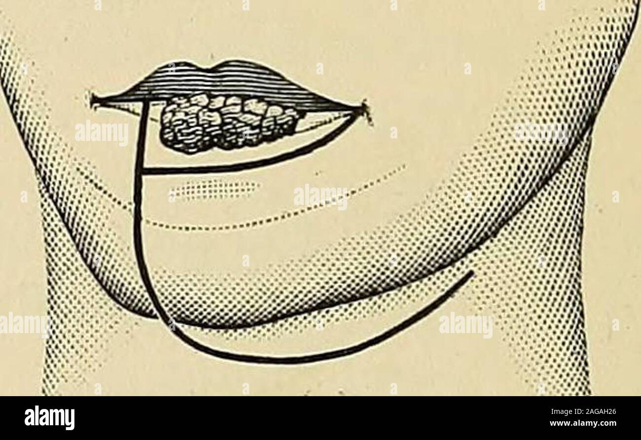 Free border of lip hi-res stock photography and images - Alamy