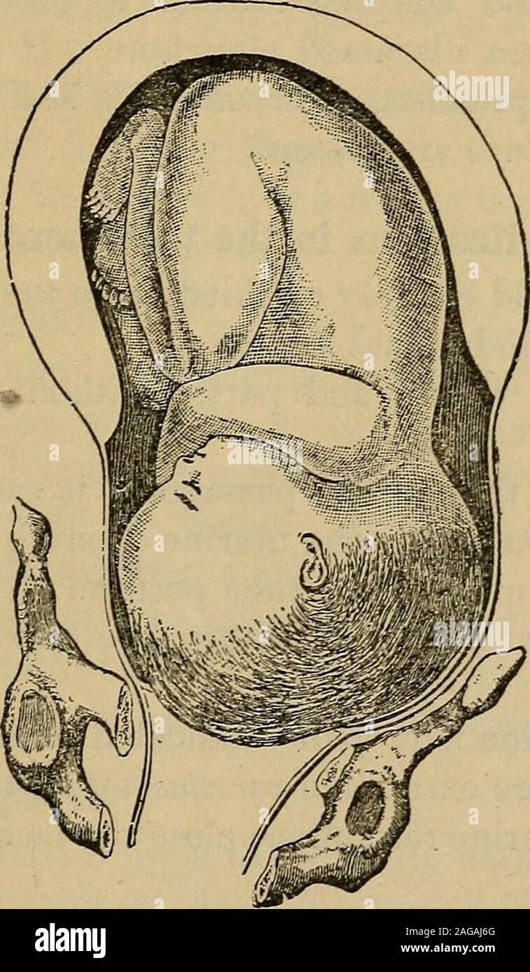 Fundus Of Uterus Stock Photos & Fundus Of Uterus Stock Images - Alamy