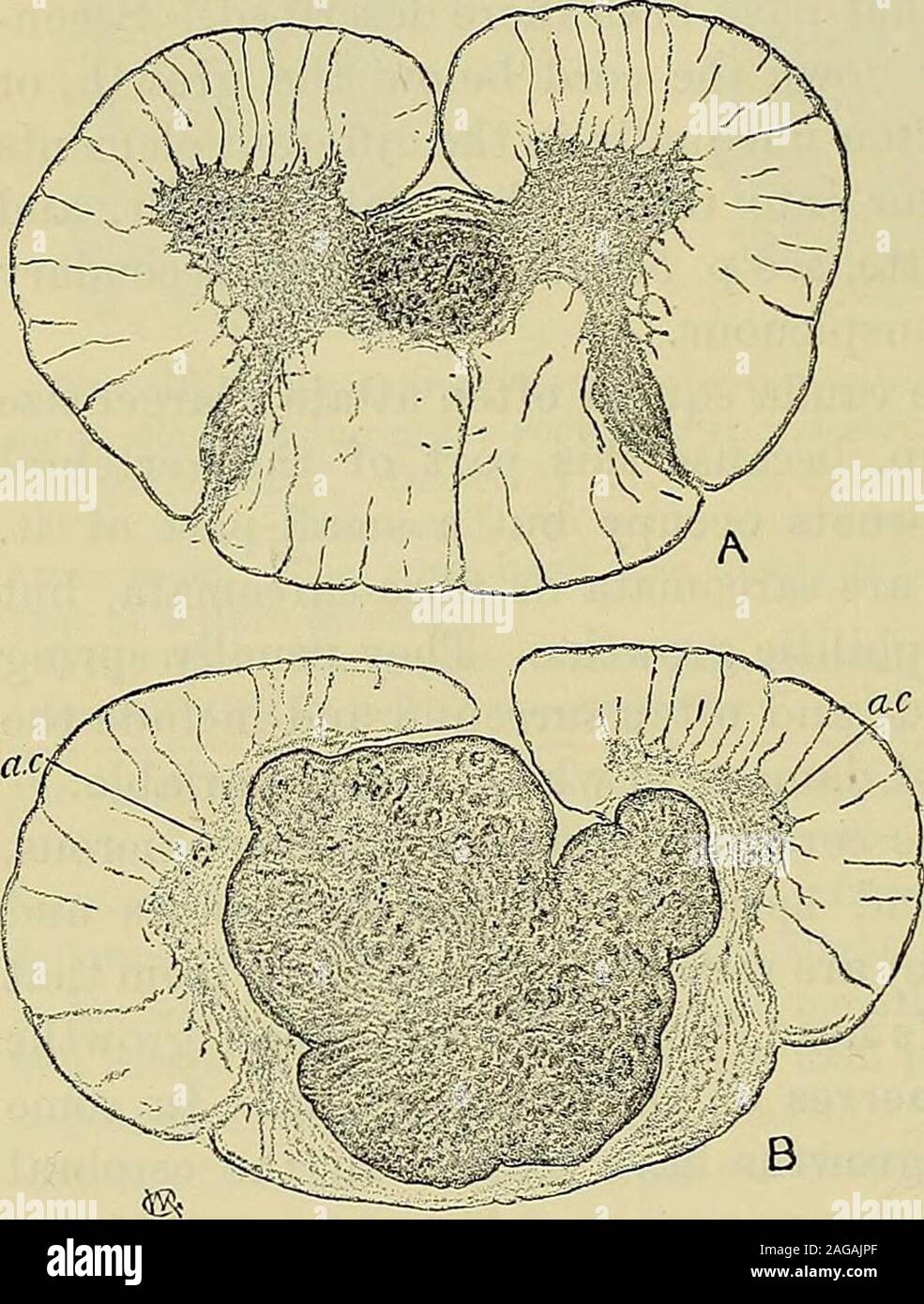 Posterior commissure hi-res stock photography and images - Alamy