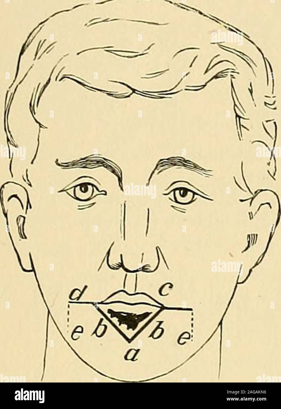 Granulation border hi-res stock photography and images - Alamy