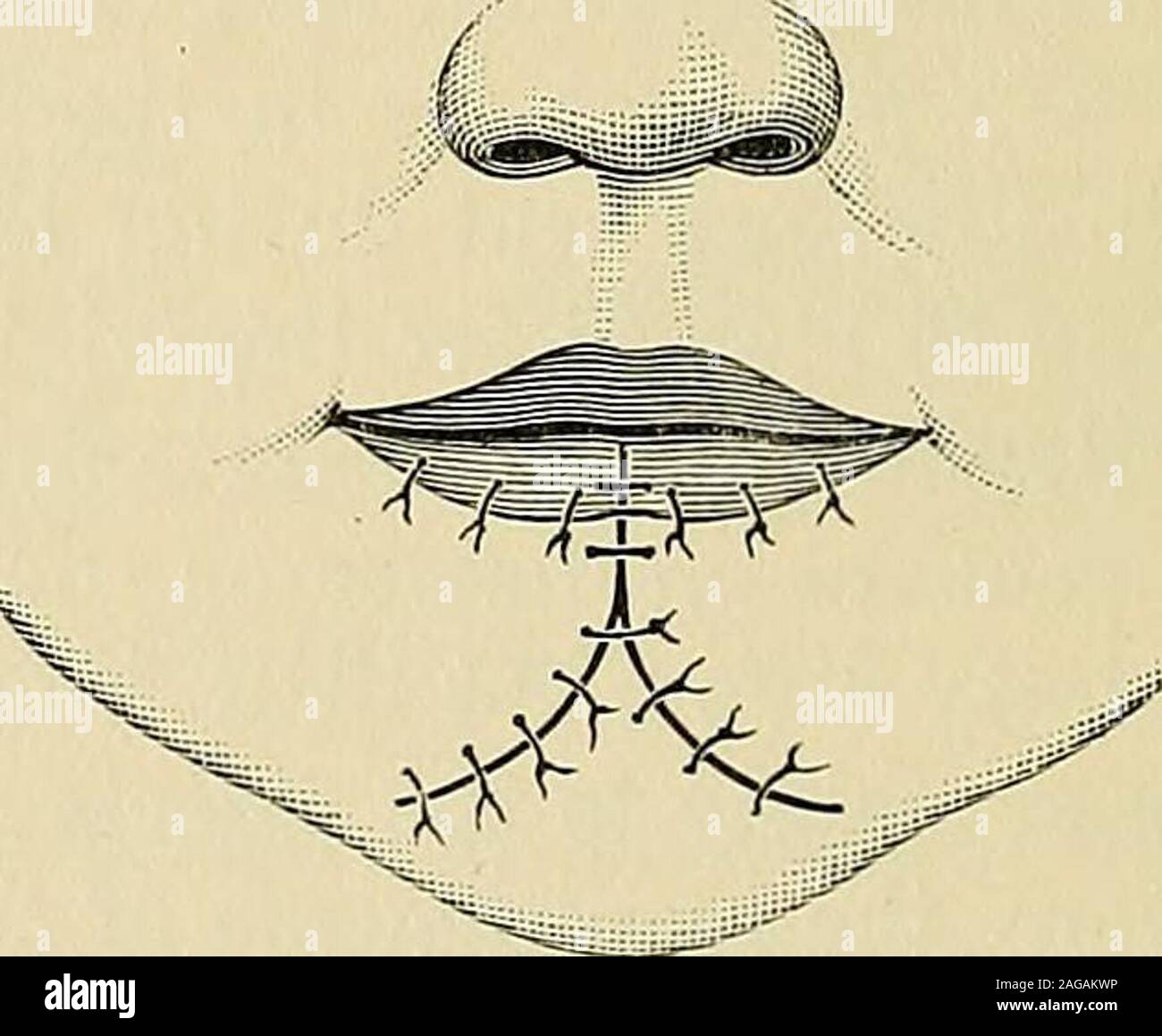 Granulation border hi-res stock photography and images - Alamy