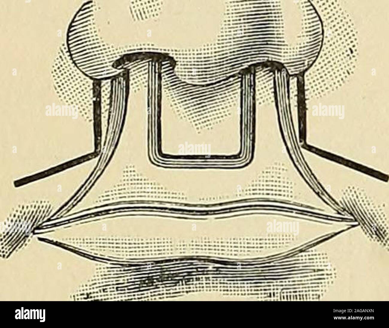 Intermaxillary bone hi-res stock photography and images - Alamy