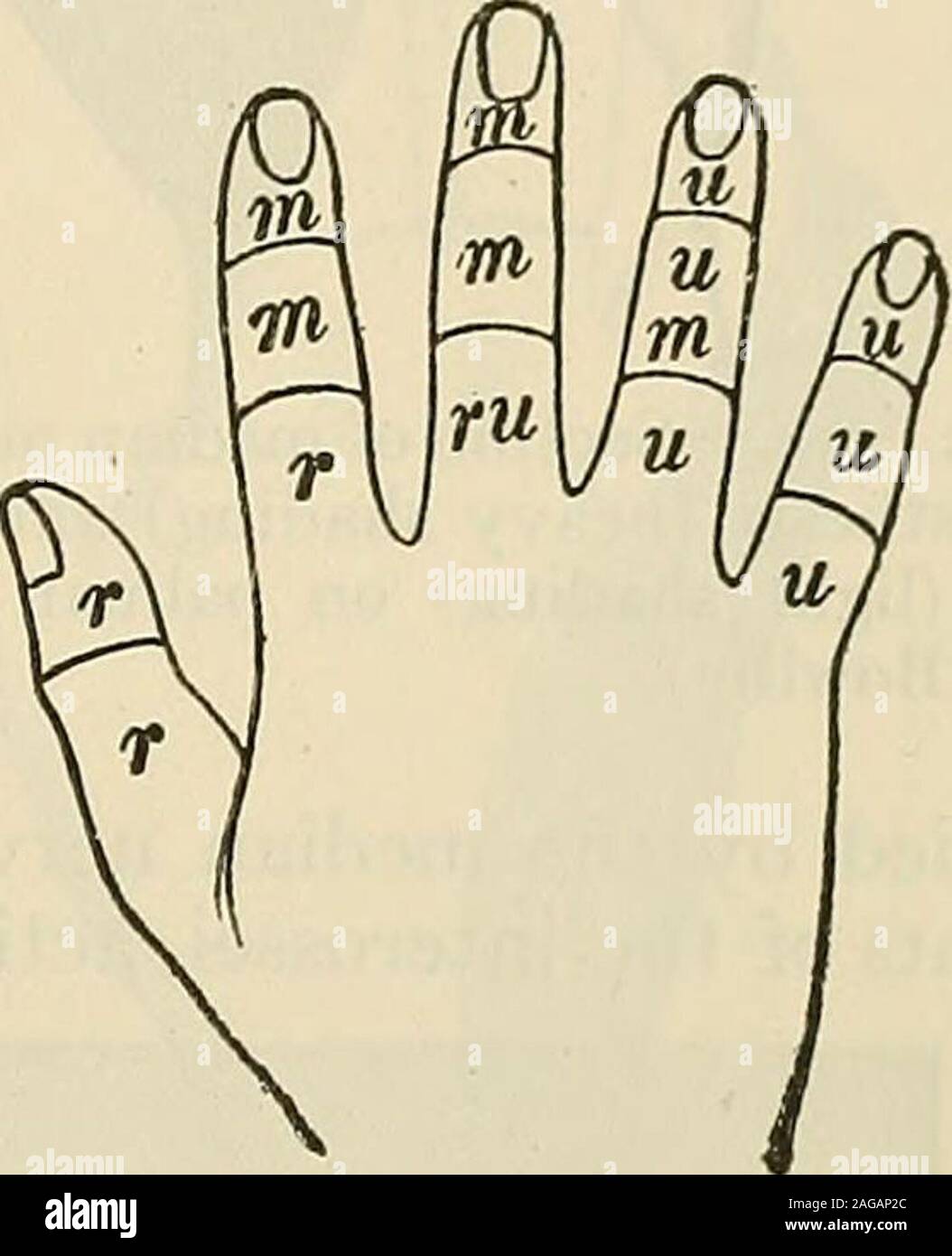 . Modern surgery, general and operative. Fig. 546.—Paralysis of ...