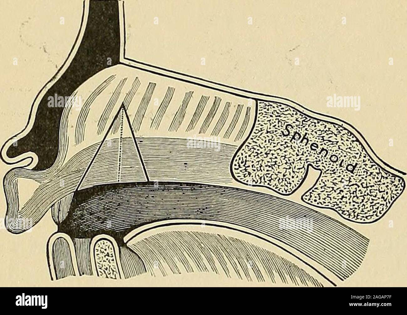 . Operative surgery. Fig. 756.—Complicatedharelip. 604 OPERATIVE ...
