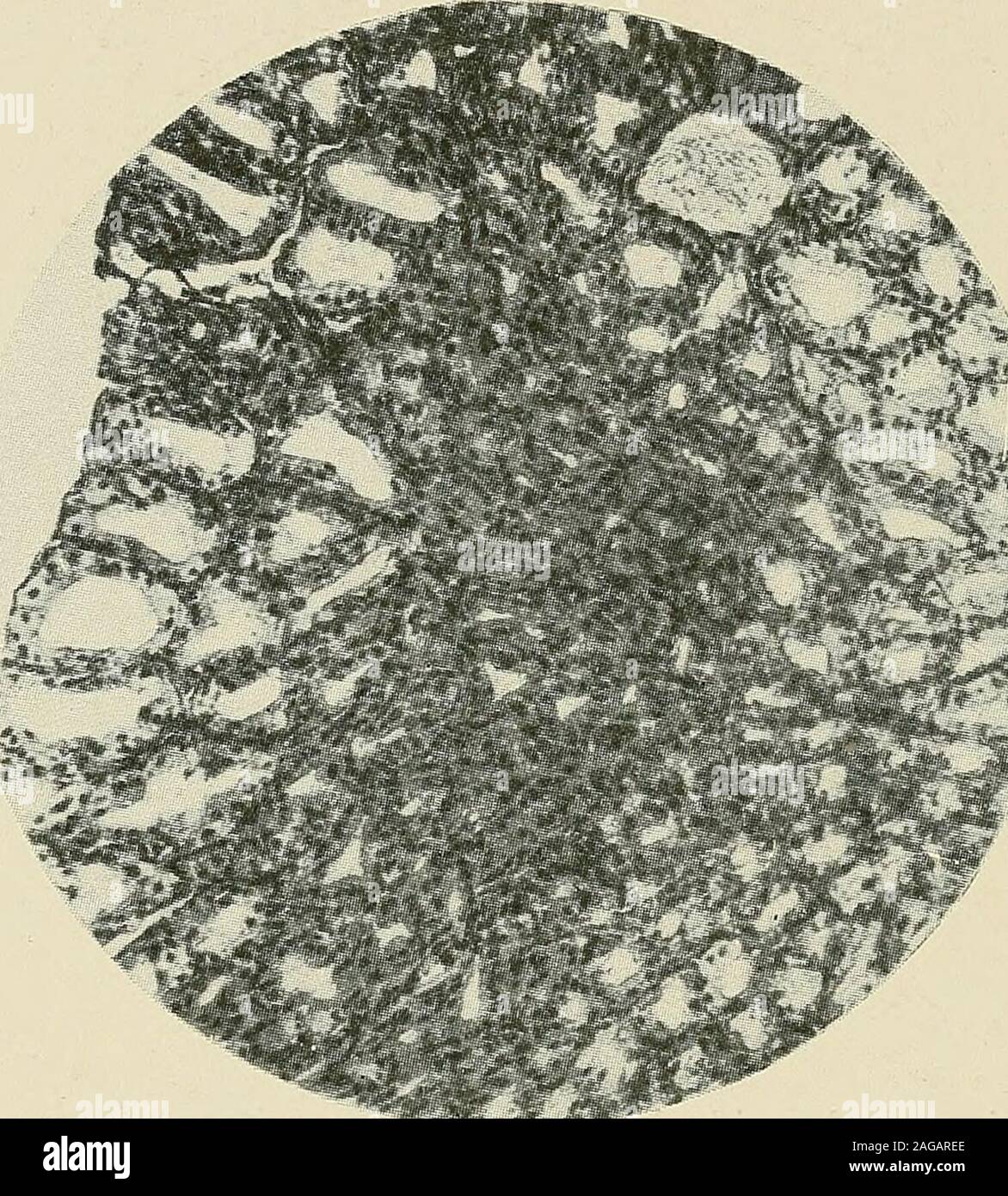 . The thyroid gland in health and disease. new acini are formed in the ...