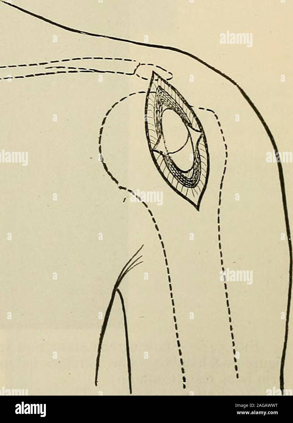 Typeone hi-res stock photography and images - Alamy