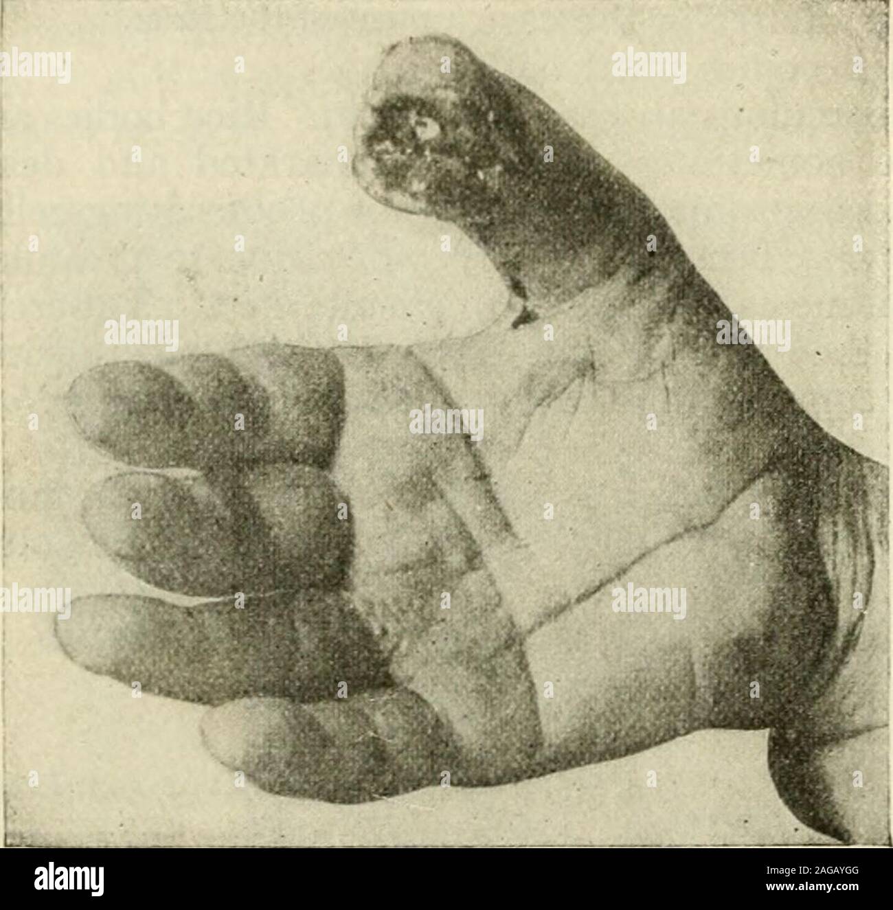 Recurrent ganglia hi-res stock photography and images - Alamy