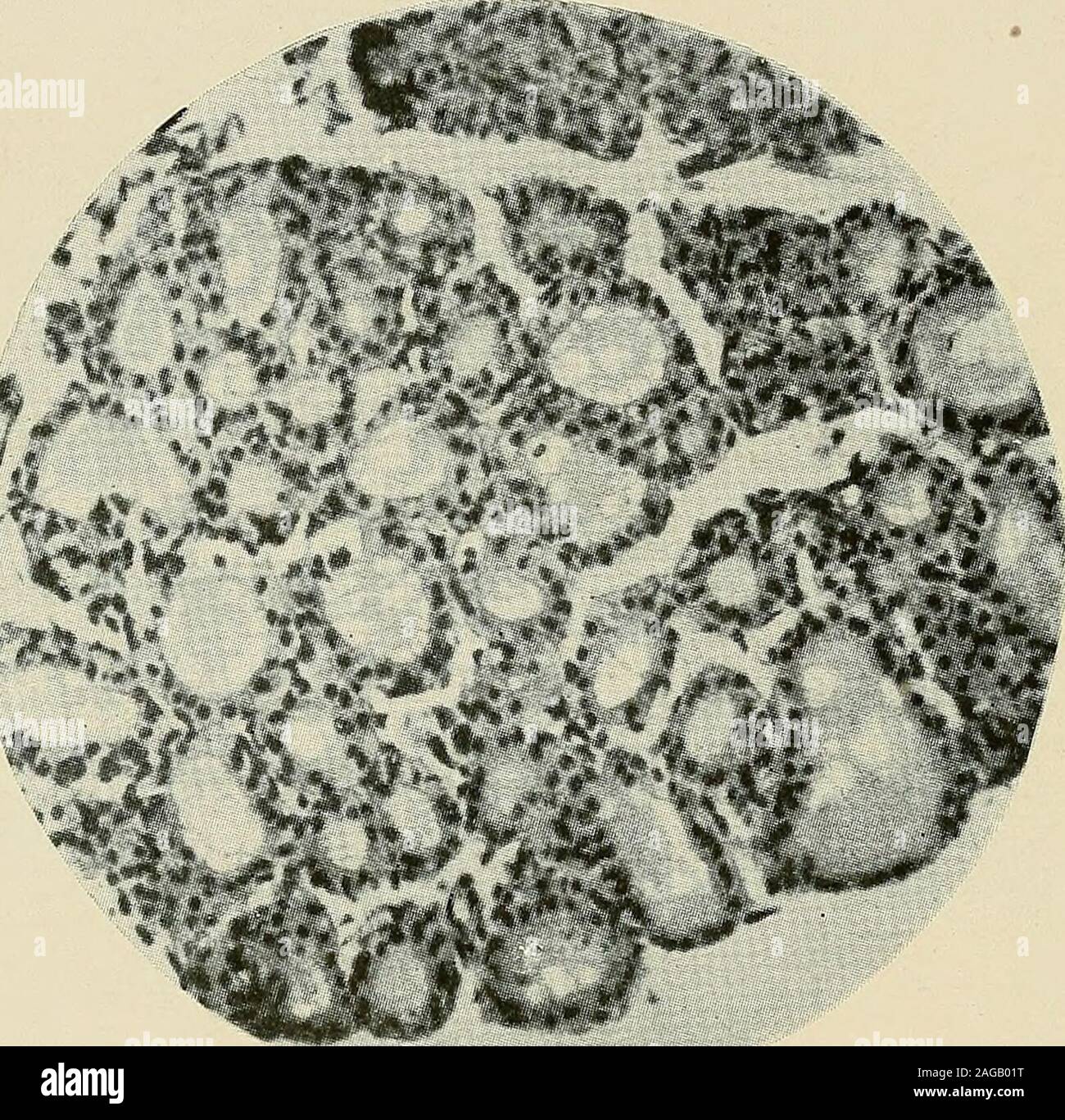 . The thyroid gland in health and disease. network. Mitotic figures and ...