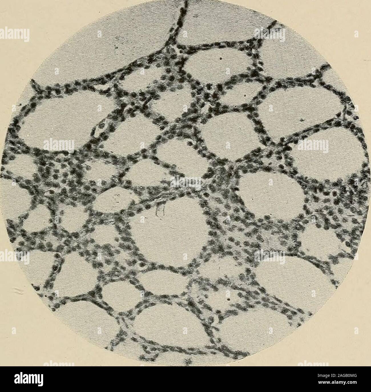 . The thyroid gland in health and disease. 300 /x. In shape theymay be ...