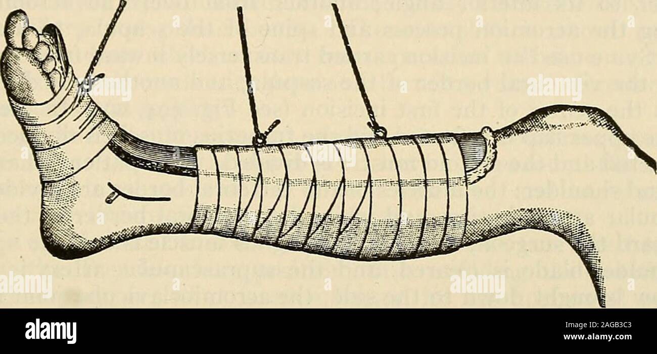 . Modern surgery, general and operative. the foot resting on its ...