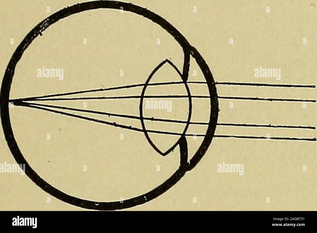 . The hygiene of the schoolroom. FIG. 13. SHOWS THE MUSCLES OF THE ...