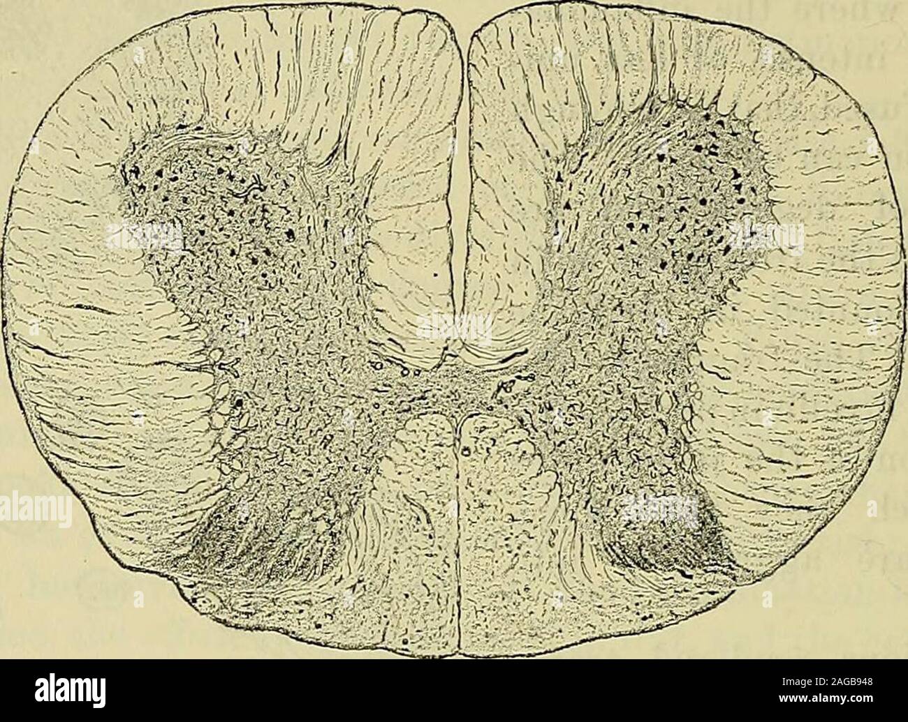Corpora amylacea hi-res stock photography and images - Alamy