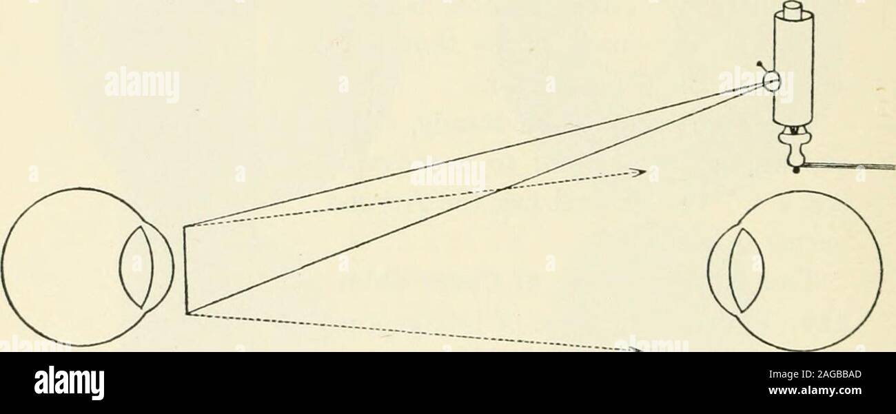 . Refraction and how to refract : including sections on optics ...