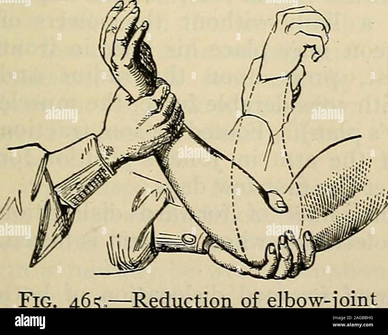 . Modern surgery, general and operative. s partially di-vided to give a ...