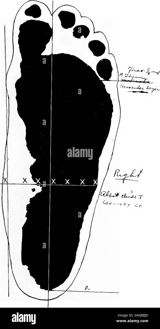 . A manual on foot care and shoe fitting for officers of the U.S. Navy ...