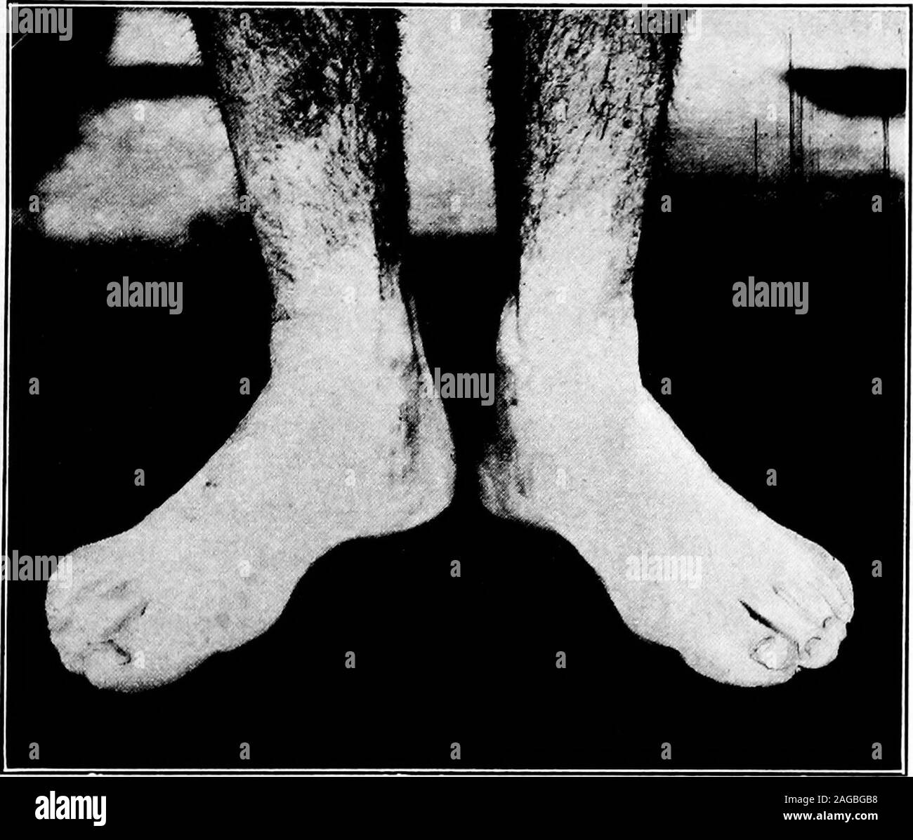 . A manual on foot care and shoe fitting for officers of the U.S. Navy ...