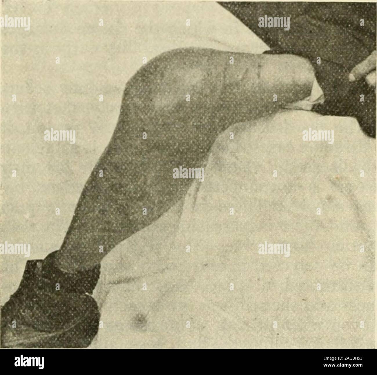 Palsied hi-res stock photography and images - Alamy