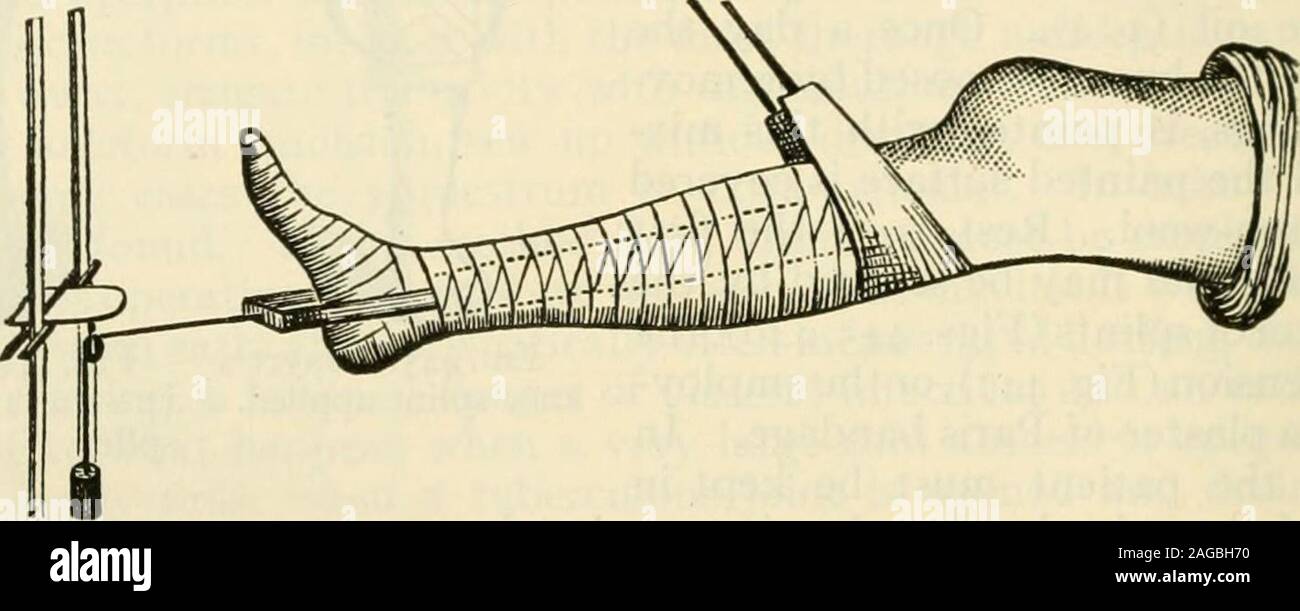 . Modern surgery, general and operative. o avoid standing upon ...