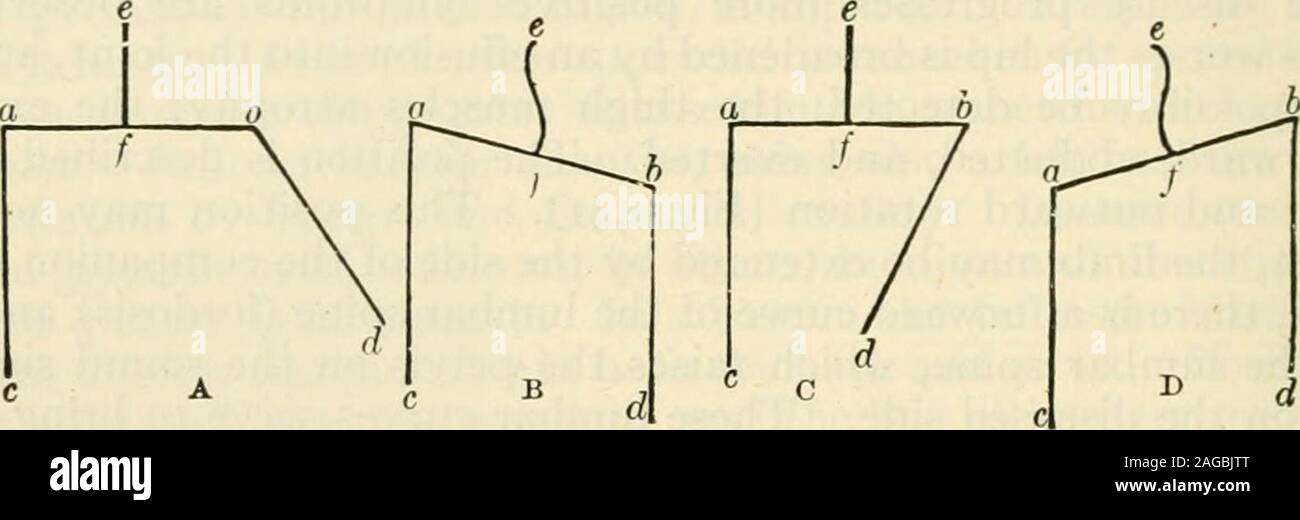 Thigh flexion hi-res stock photography and images - Alamy