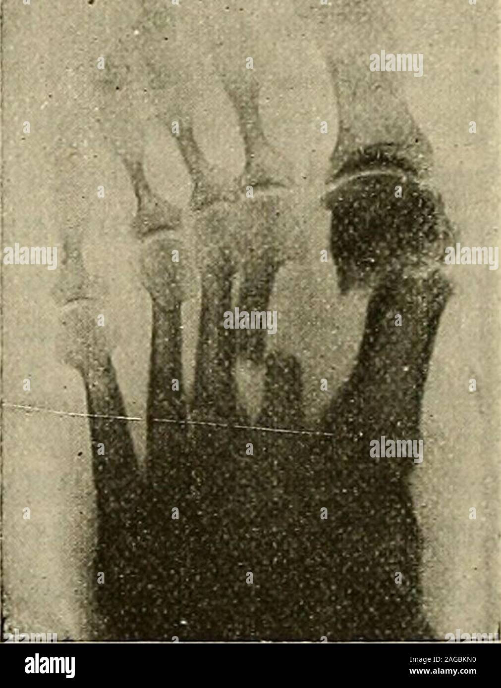 . Modern surgery, general and operative. n and fixation or removal ...