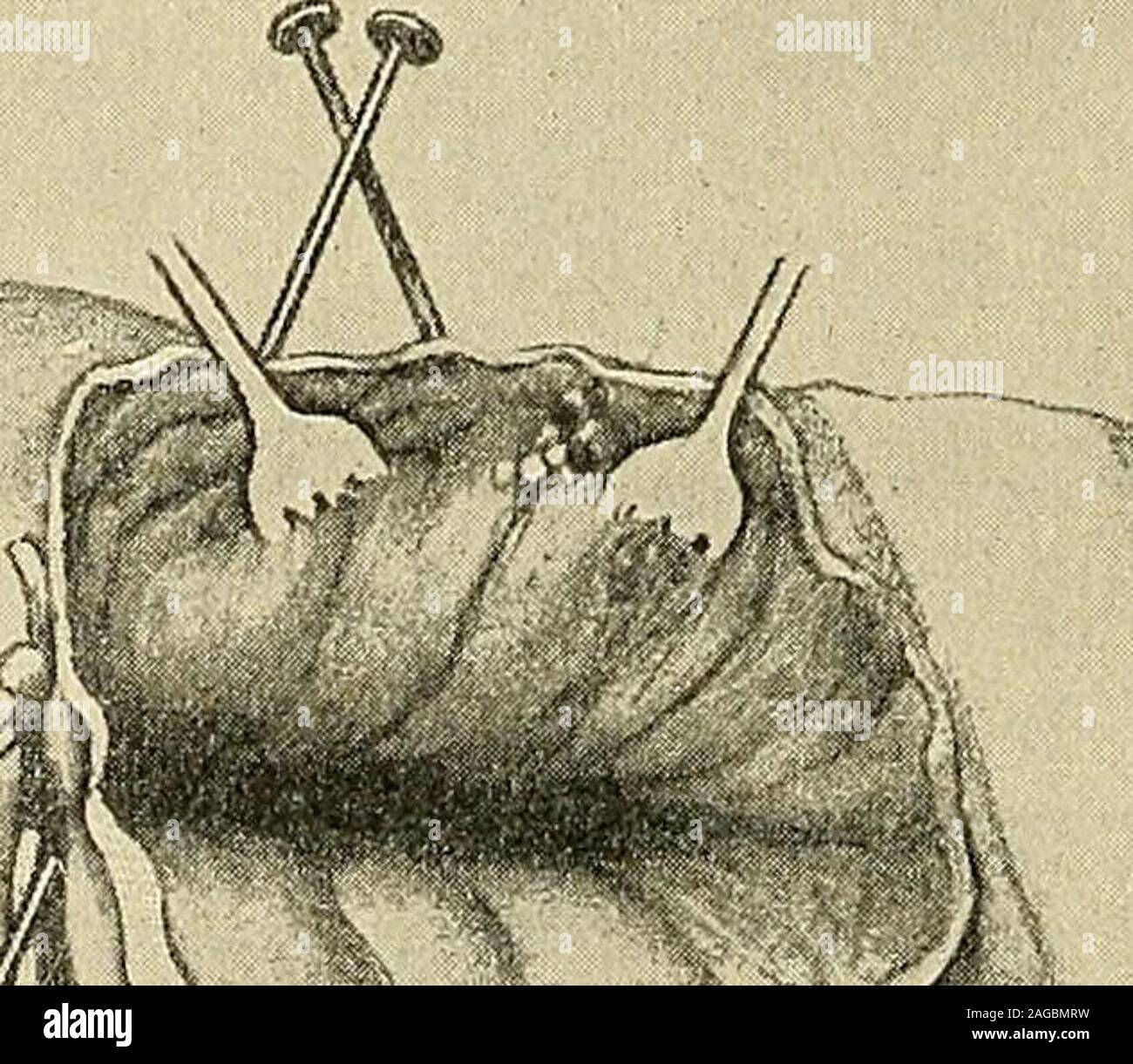 Lowerpoint hi-res stock photography and images - Alamy