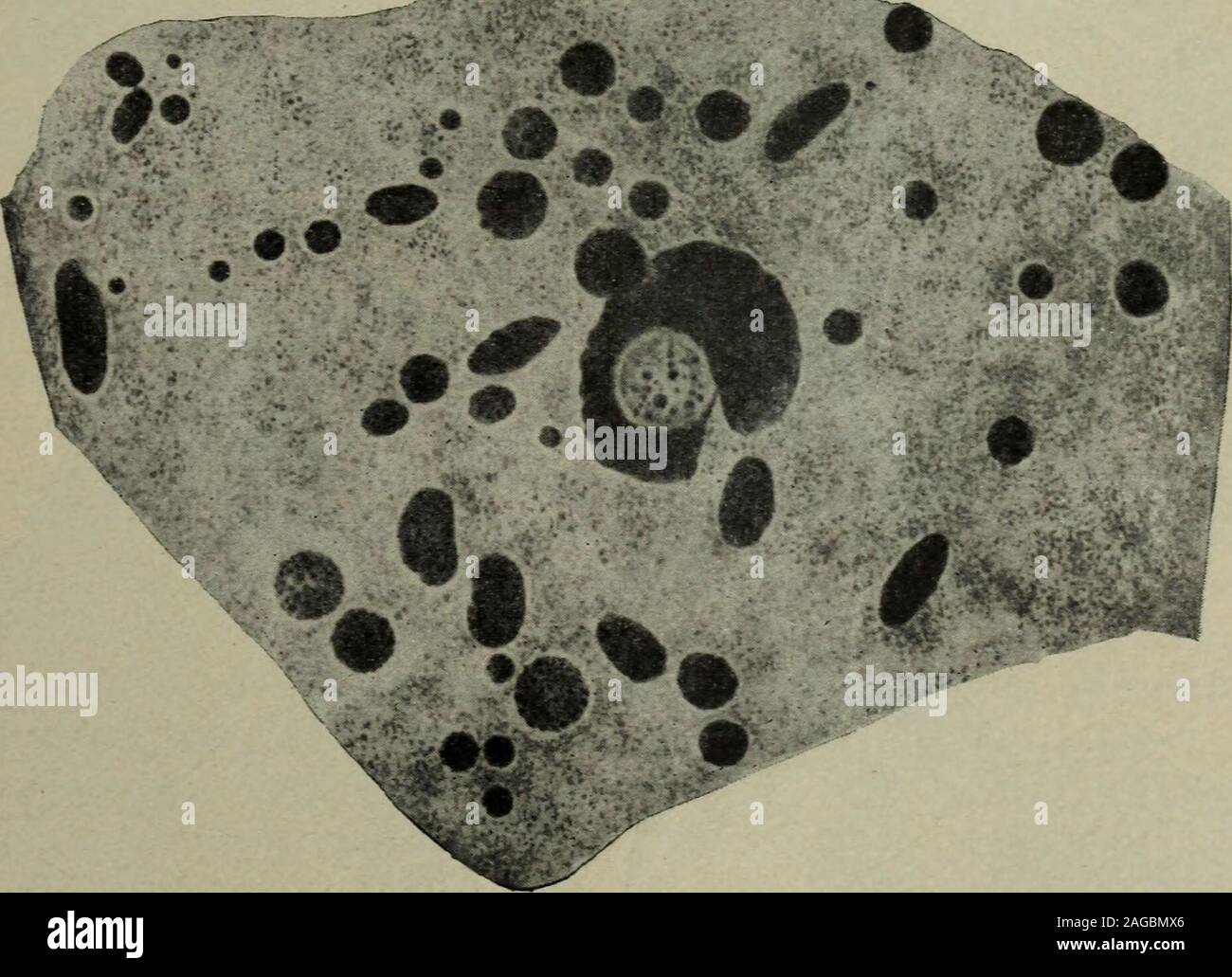 Micronucleus And Macronucleus