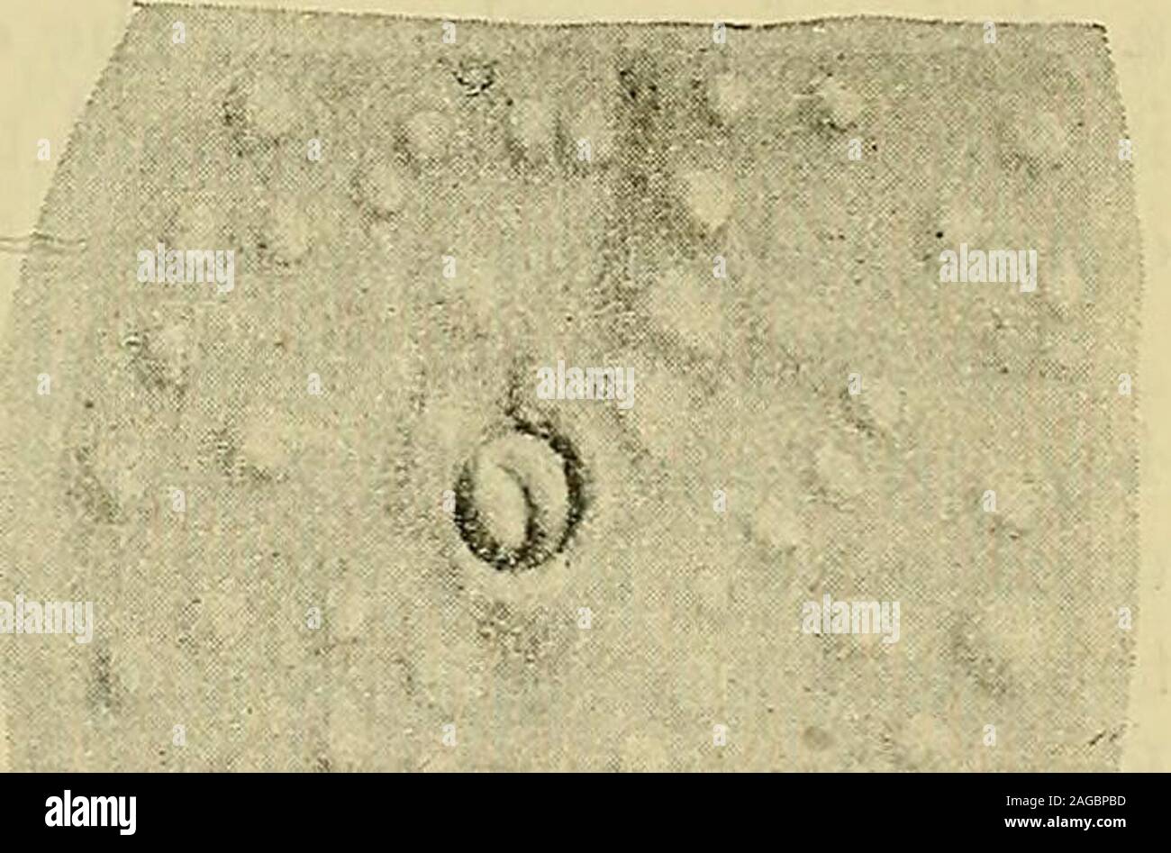 . A manual of diseases of the nervous system. roma, is recorded by Mr ...