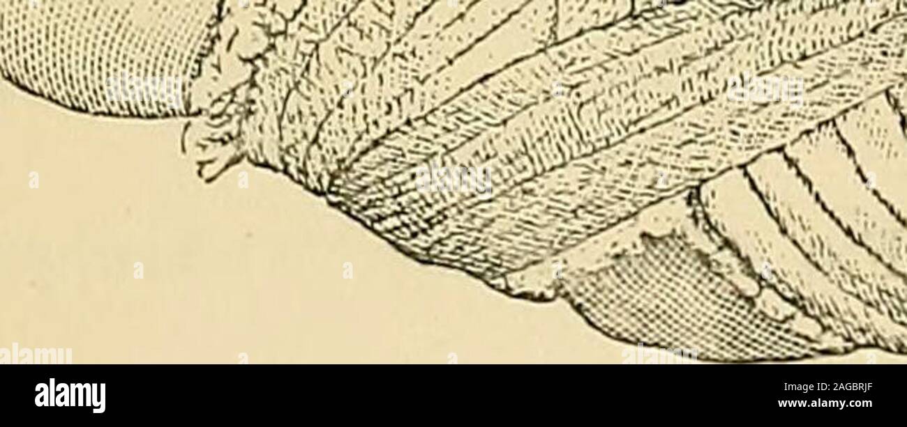 . Operative surgery. ; ; ..lit; Fig. 645.—Stump dressed with anliseptic ...