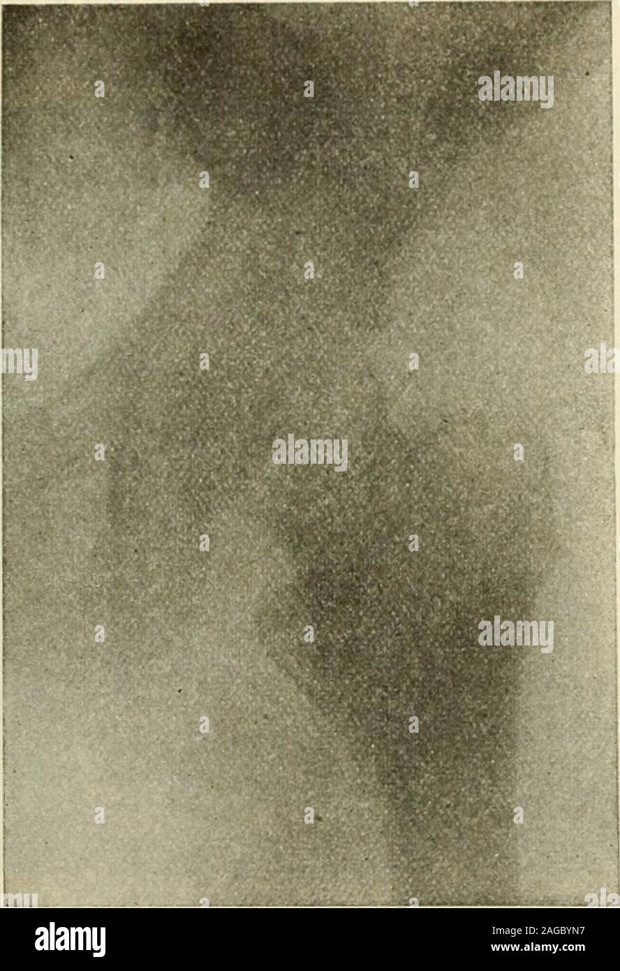 Allis sign hi-res stock photography and images - Alamy