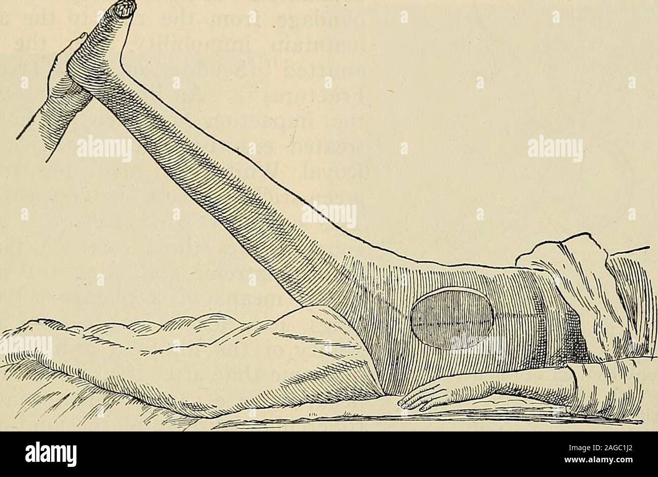 Inverted leg hi-res stock photography and images - Alamy