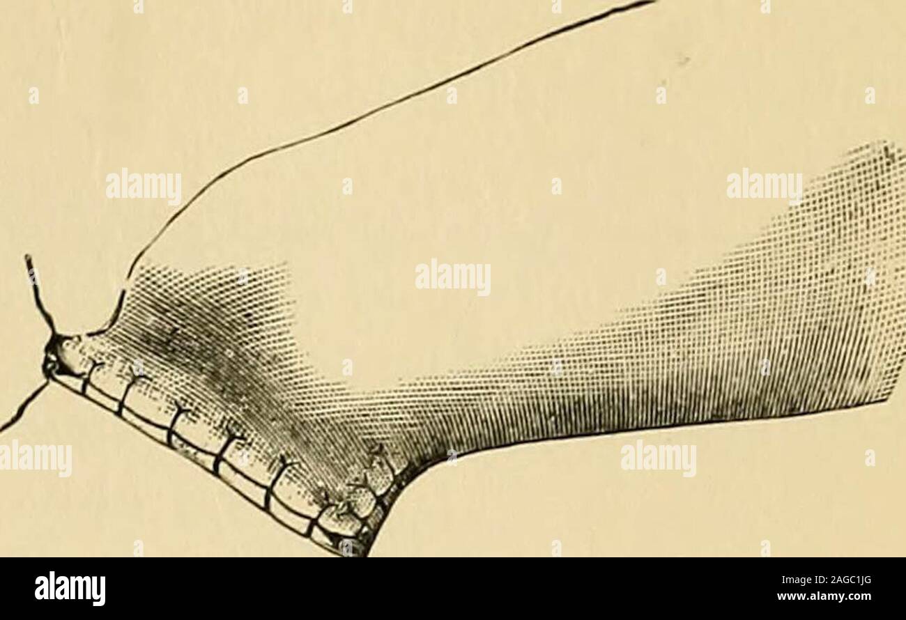 . Operative surgery. Pig. 633.—Antero-posterior coaptation.. Fig. 633 ...