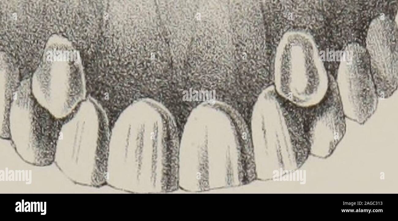 . The anatomy, physiology and pathology of the human teeth : with the ...