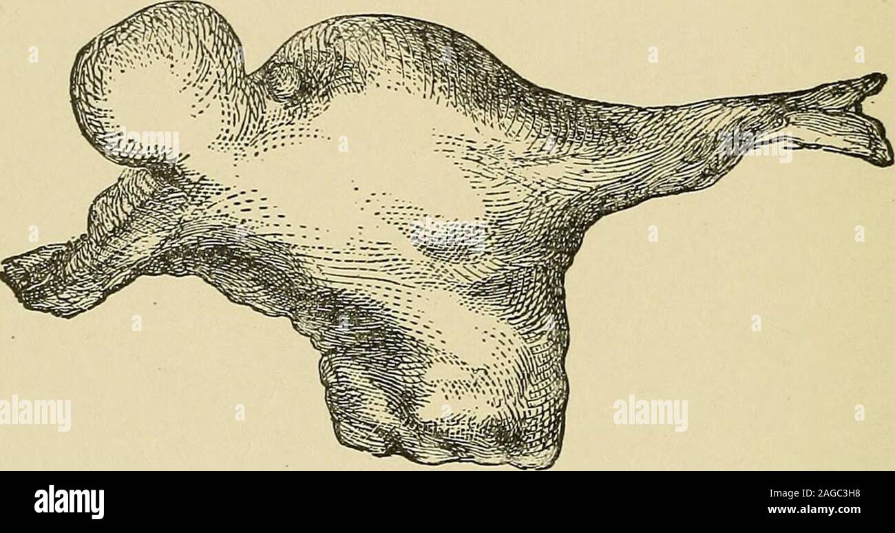 . Essentials of gynecology, arranged in the form of questions and ...